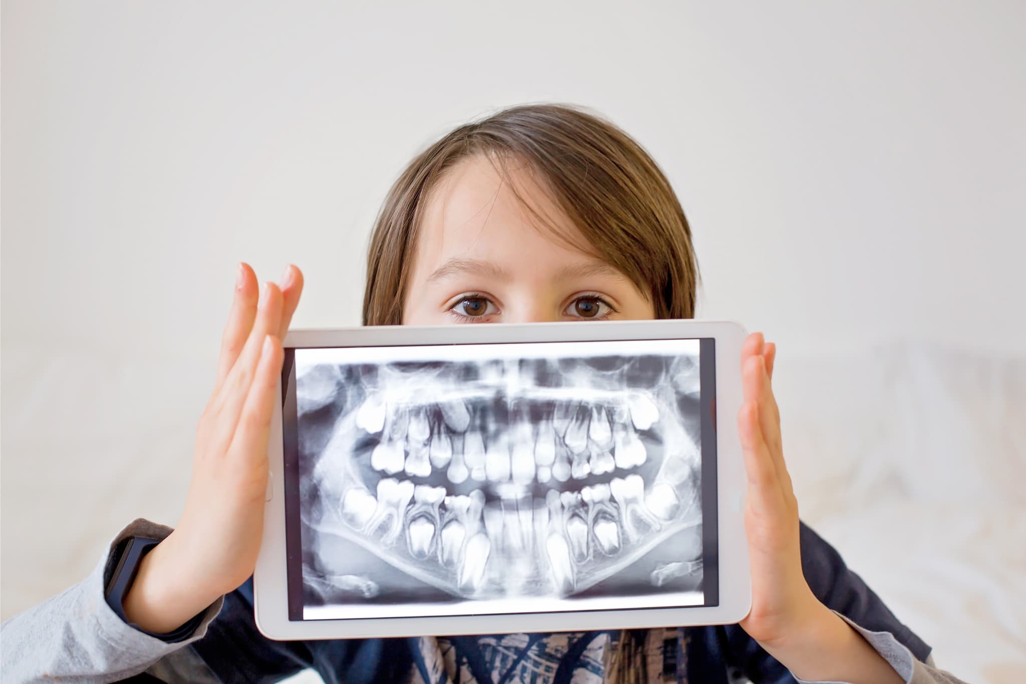 Paediatric Dental X-Rays: Balancing Necessity, Safety & Guidelines